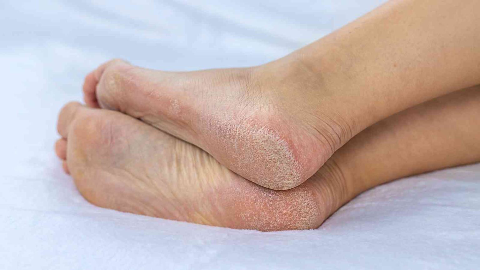 19 Uses of Coconut Oil Beyond The Kitchen